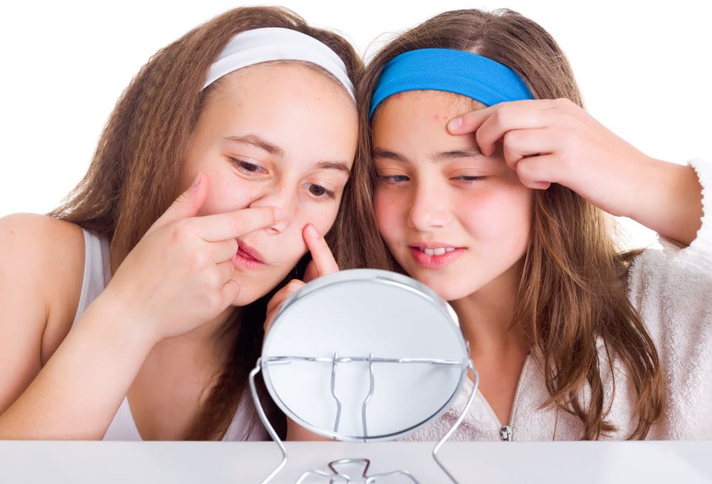 Teenage Skin: A Parents Guide To Treating Acne In Teens and Kids ...
